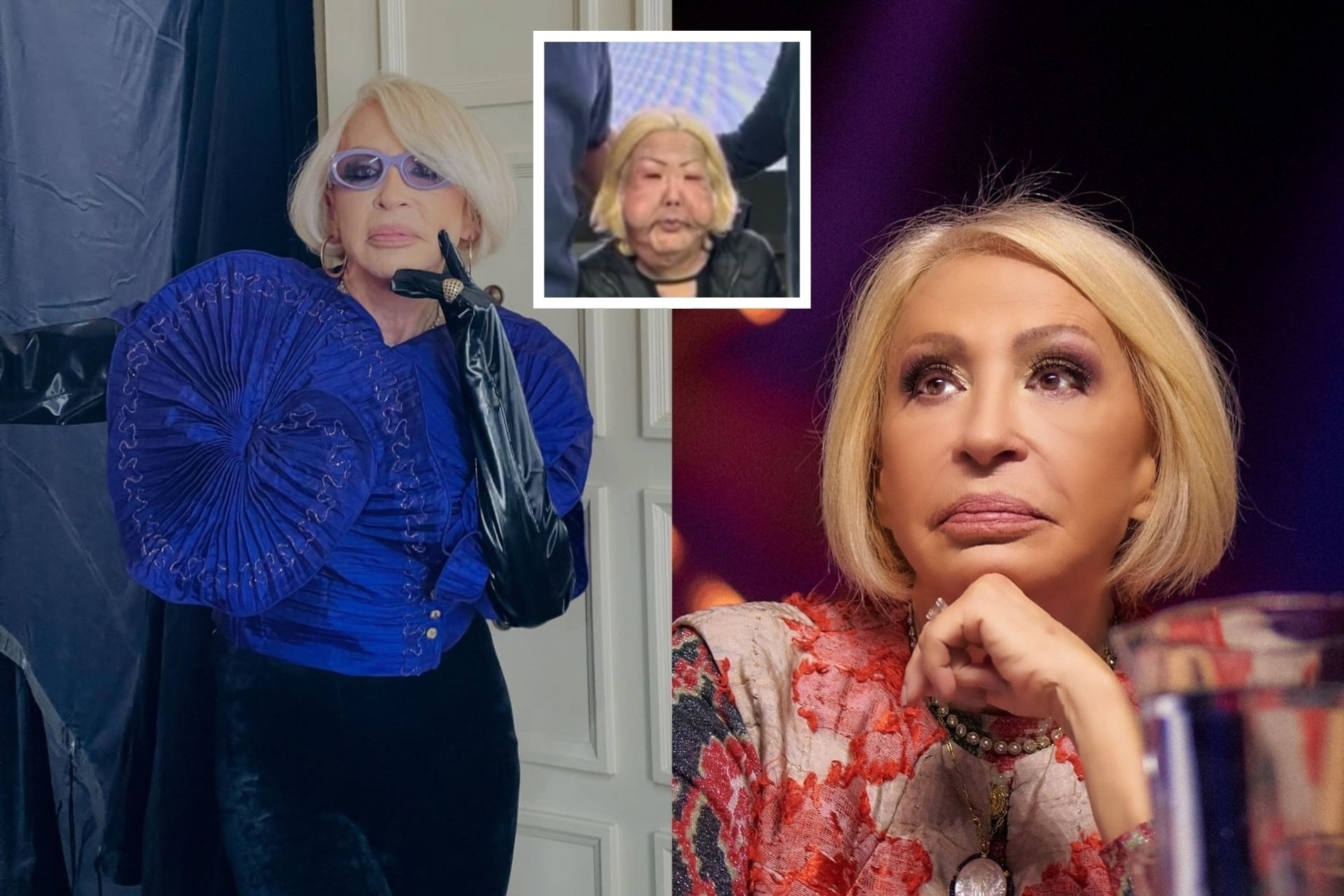 ¿Laura Bozzo quedó desfigurada tras cirugía? Esta es la verdad detrás ...